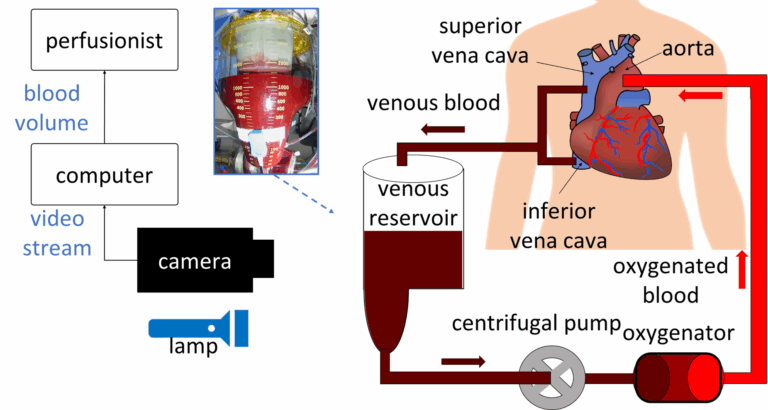 LTU, industry partner develop computer vision-based blood volume sensor ...